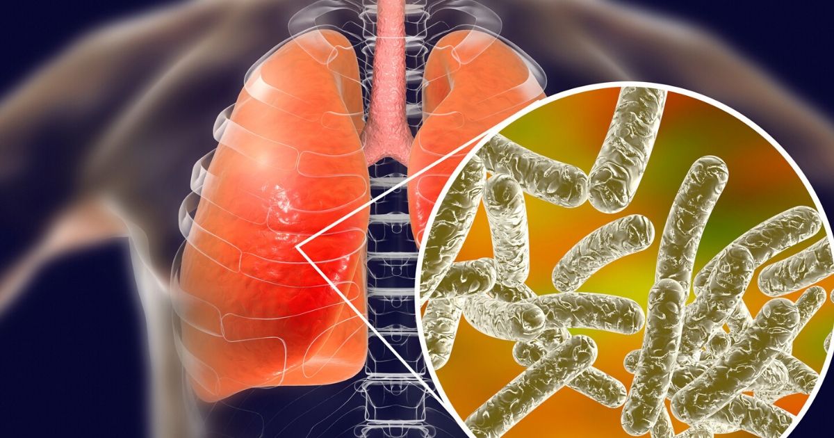 The Beginners Guide To Legionella - What All Employers Should Know ...